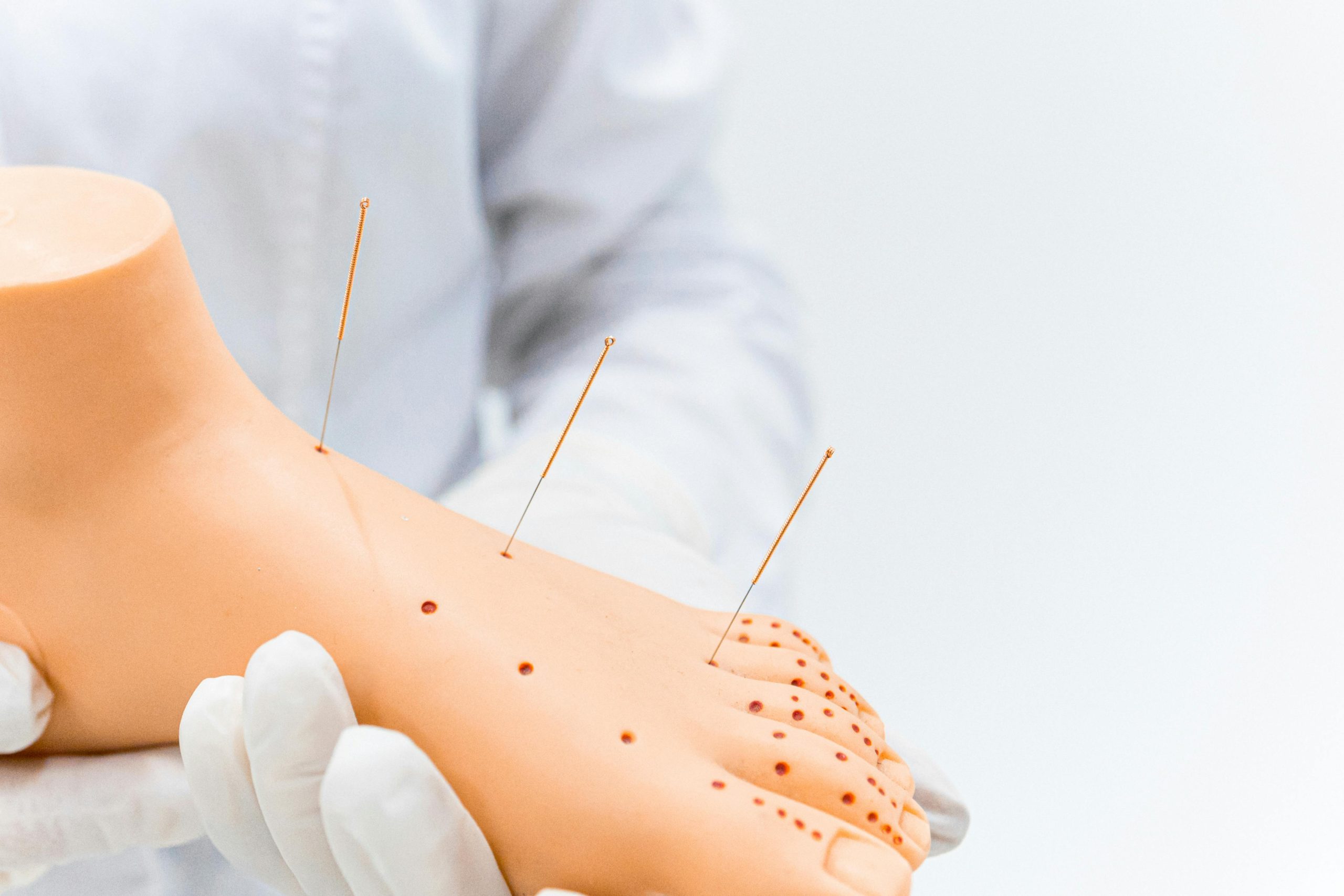 Musculoskeletal Relief: Dry Needling Precision Therapy